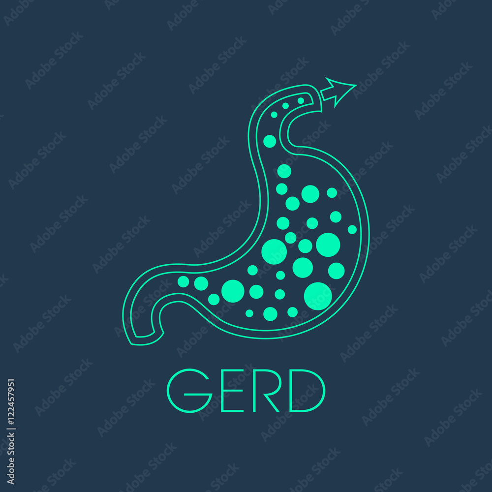 gerd logo vector icon Stock Vector | Adobe Stock