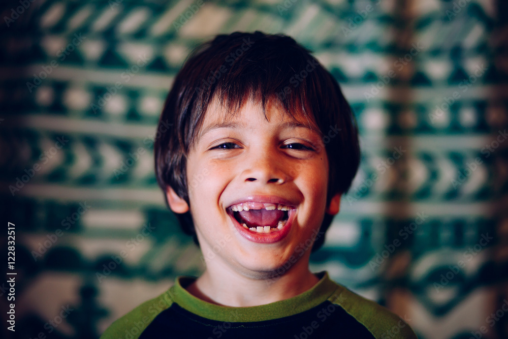 Young toothless boy smiling Stock Photo | Adobe Stock