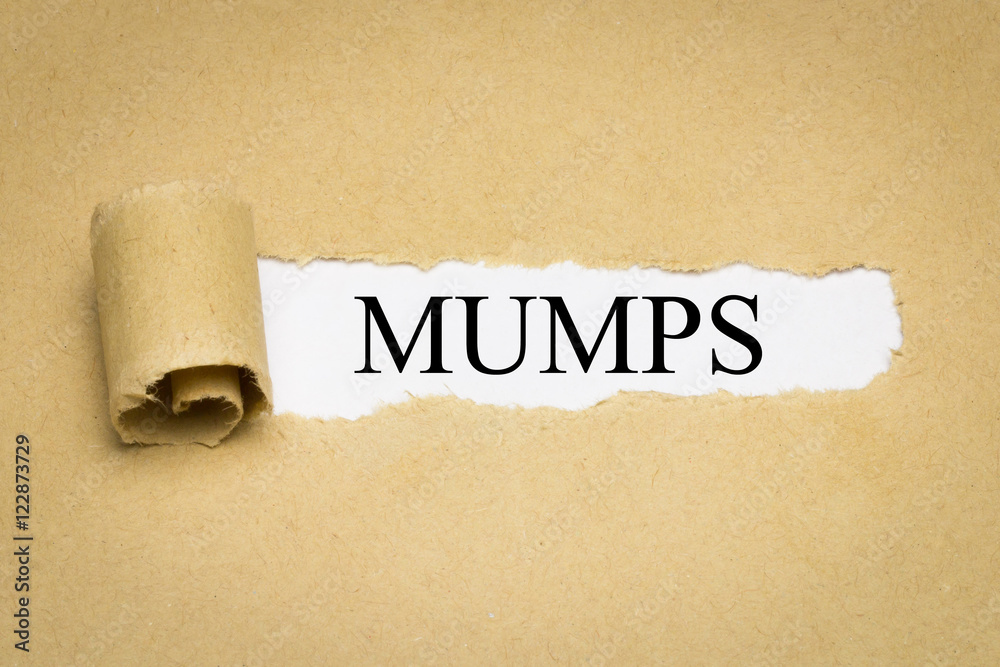 Mumps Stock-Foto | Adobe Stock