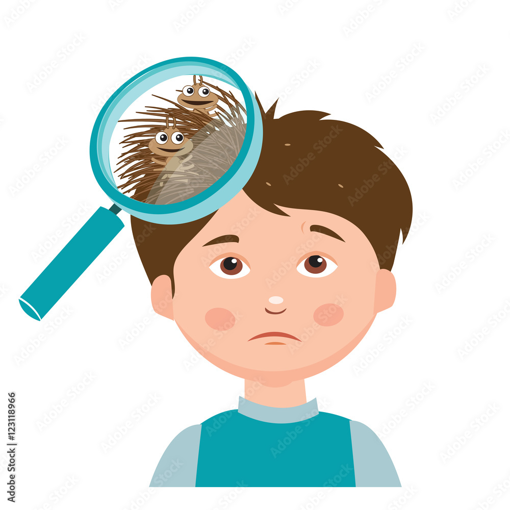 Boy With Lice. Magnifying Glass Close Up Of A Head. Vector Illustration ...