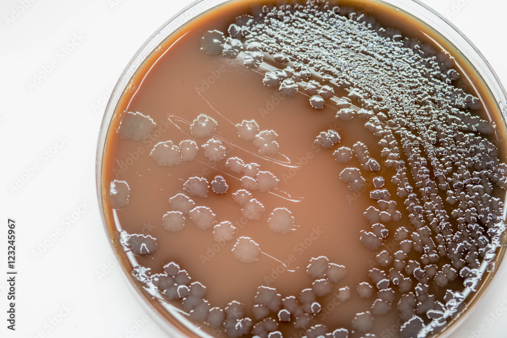 Bacterial colonies culture on Chocolate agar. (CA agar) Stock Photo ...