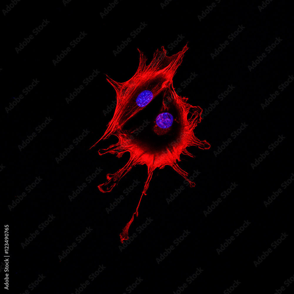 Confocal microscopy imaging of two cancer cells touching each other ...