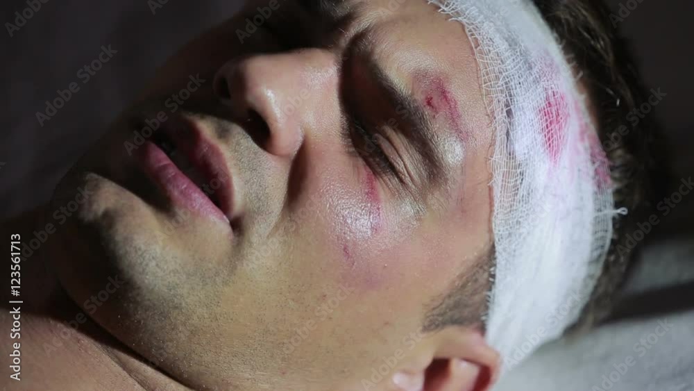 man with head injuries lying on the bed. bandaged head. bruise on his ...