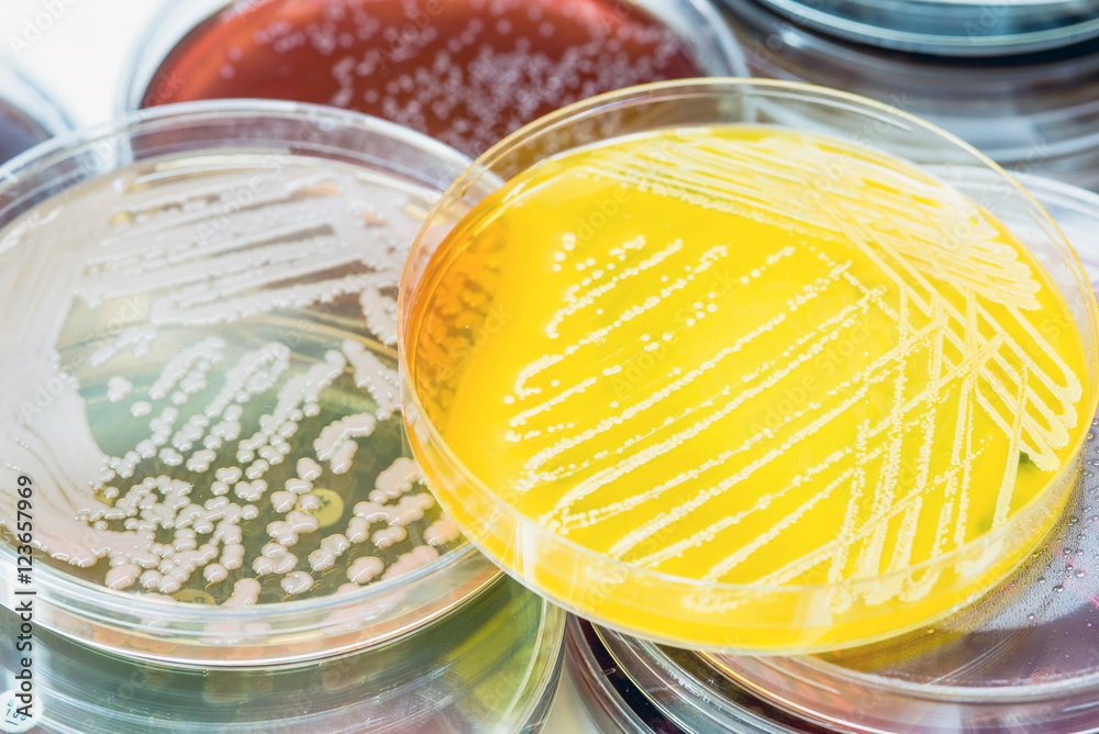 Bacterial culture growth on selective media. Stock Photo | Adobe Stock