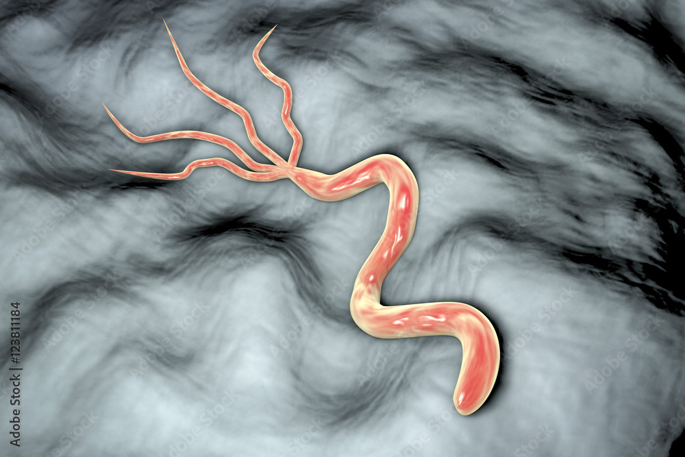 3D illustration of Helicobacter pylori, bacterium which causes gastric ...