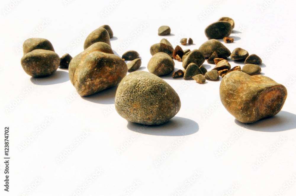 Gallensteine. Stock Photo | Adobe Stock