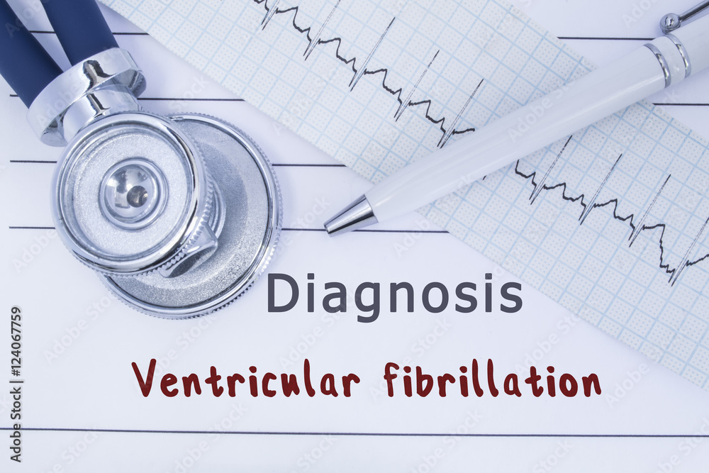 Diagnosis Ventricular fibrillation. Stethoscope or phonendoscope ...