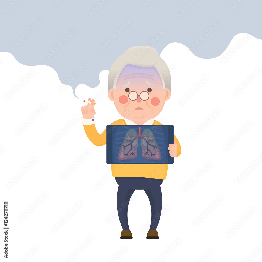 Vector Illustration of Old Man Smoking Cigarette While Holding X-ray ...