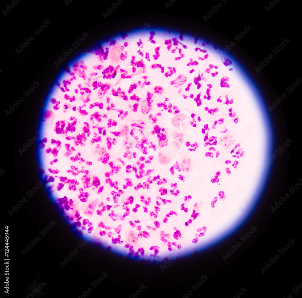blood smear is often used as a follow-up test to abnormal resul Stock ...