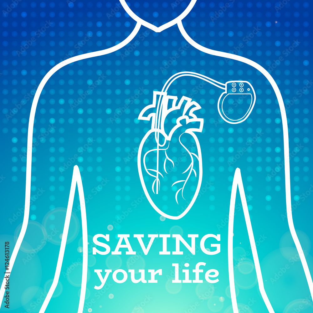Heart with pacemaker medical wallpaper,vector illustration.Human Heart ...
