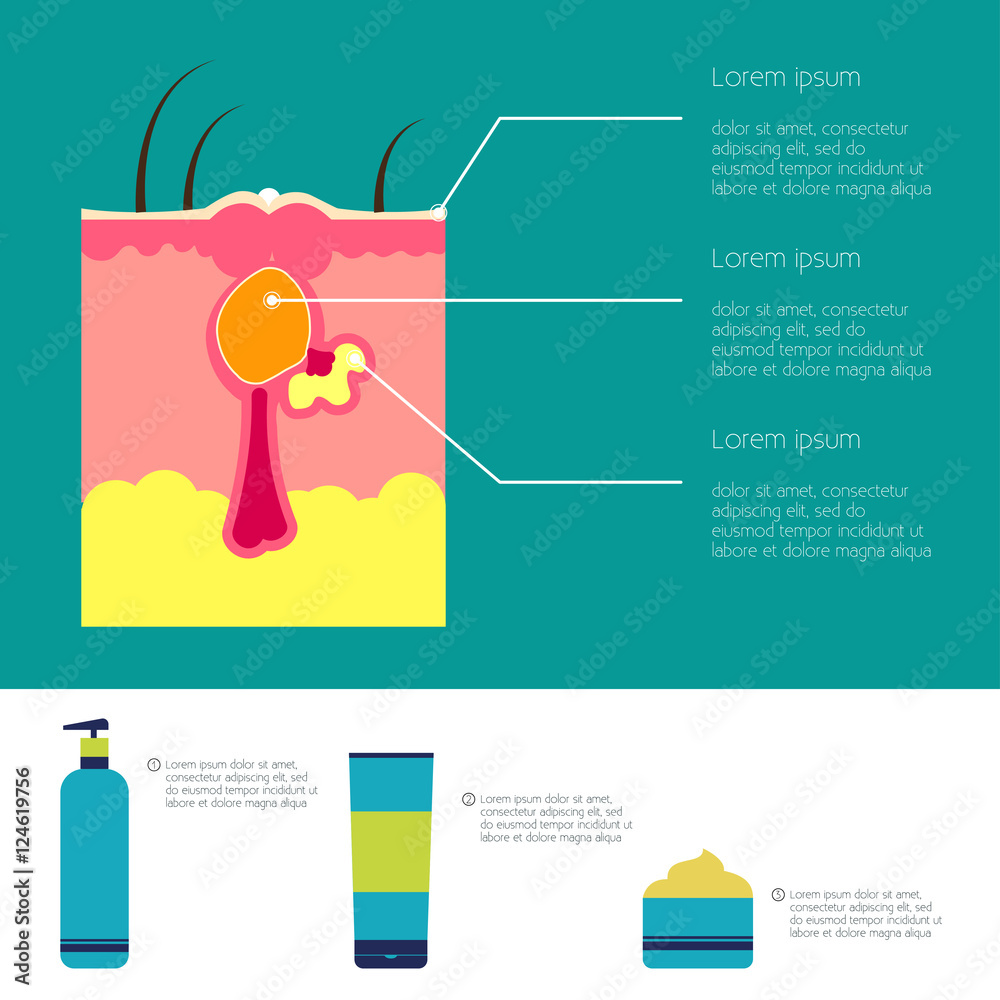 Skin problems Vector illustration Infographic of skin problems ...