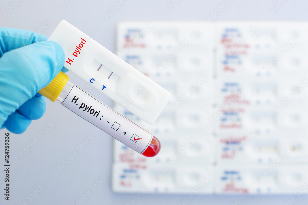 Foto de H. pylori testing by using rapid test cassette, the result ...