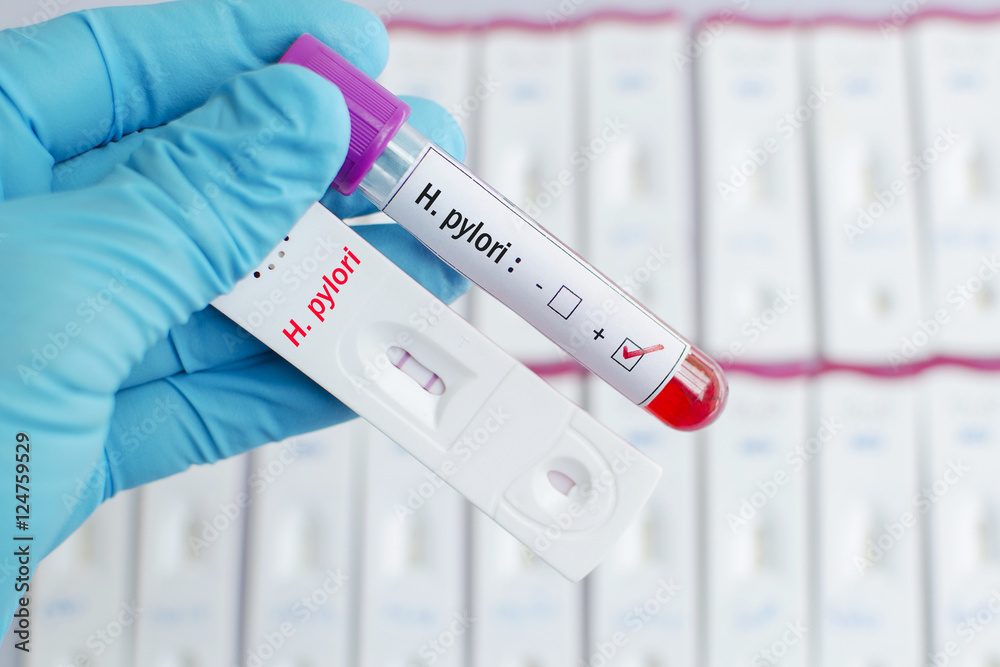 H. pylori testing by using rapid test cassette, the result showed ...