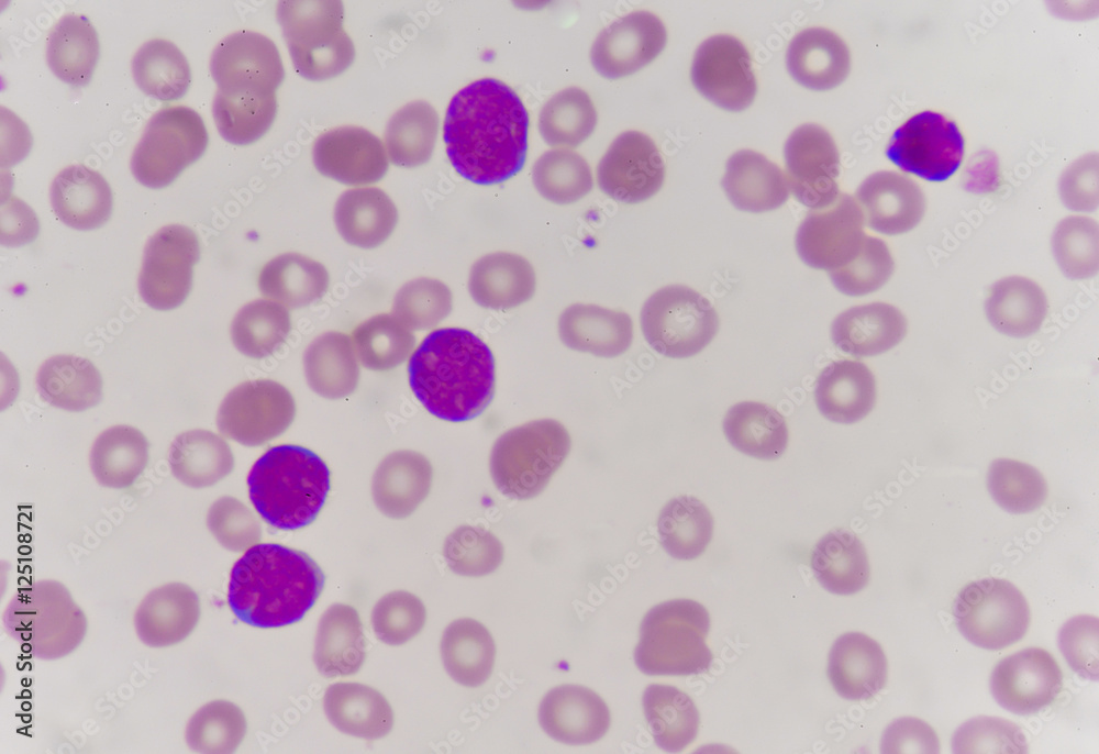 blood smear Stock Photo | Adobe Stock