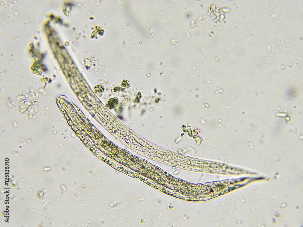 Strongyloides stercoralis (threadworm) in stool, analyze by microscope ...