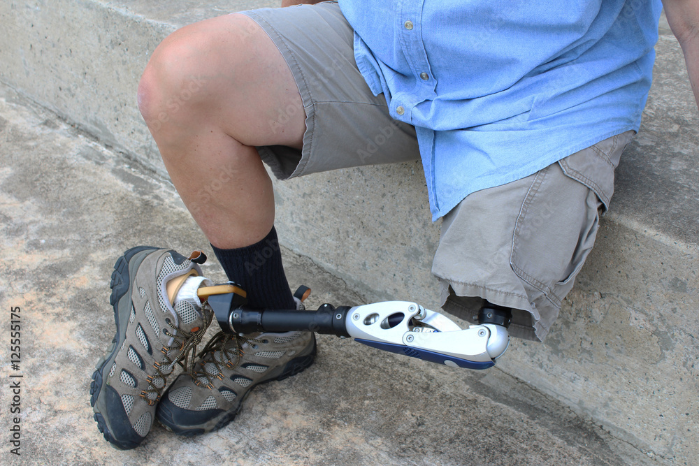 Amputee seated with leg and prosthesis crossed, detail Stock Photo ...