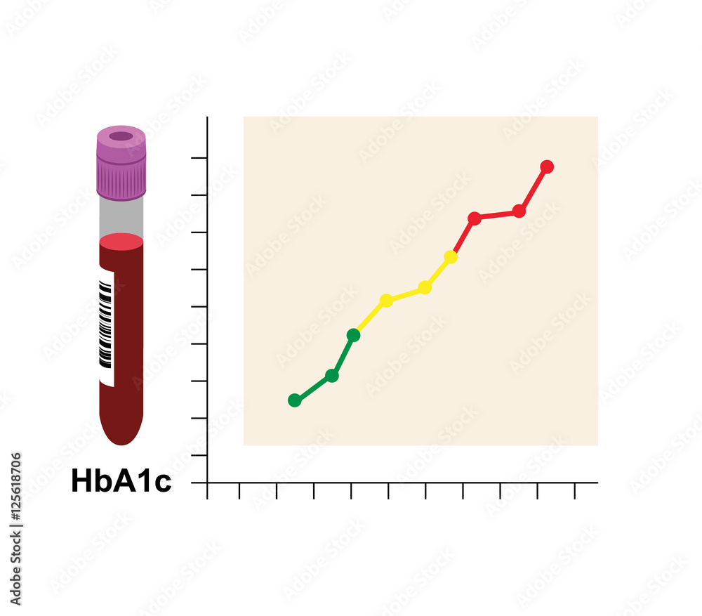 Vector image of a test tube and chart with HbA1c Stock Vector | Adobe Stock