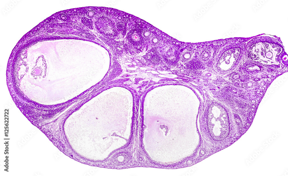 Light micrograph of ovary showing primordial, primary and secondary ...