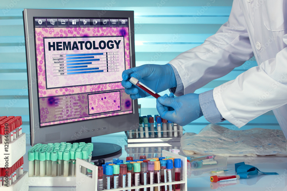 hematology test. technician in hematology lab testing blood sample in ...