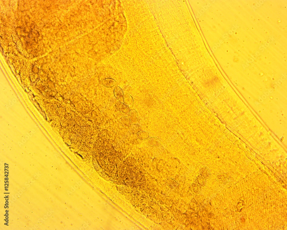 Human whipworm (Trichuris trichiura) female - permanent slide plate ...