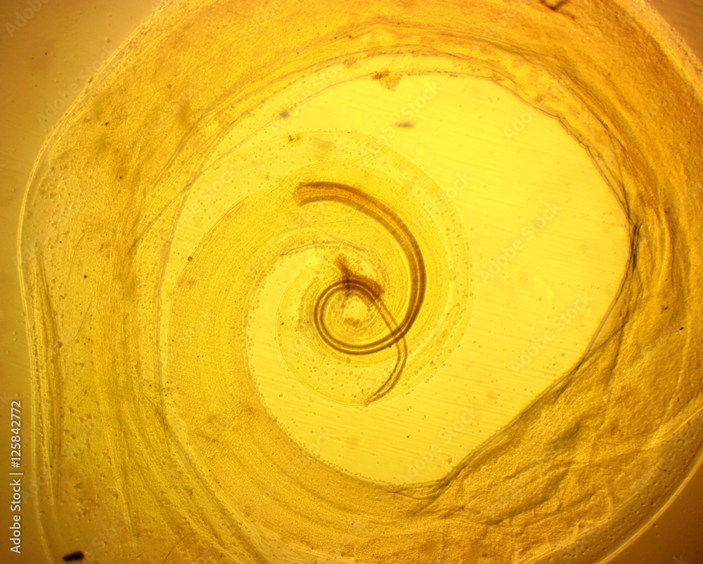 Human whipworm (Trichuris trichiura) male - permanent slide plate under ...