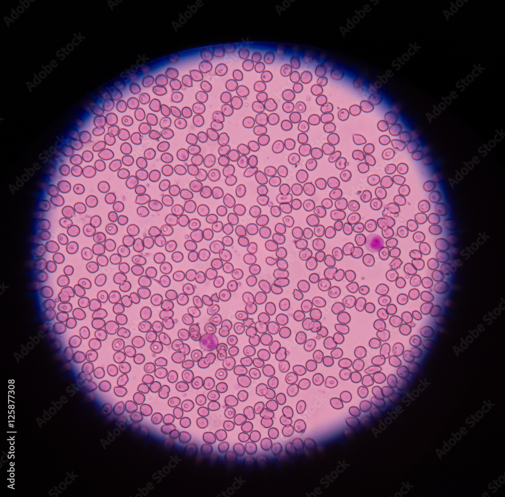 red blood cells under microscope in medical background concept. Stock ...