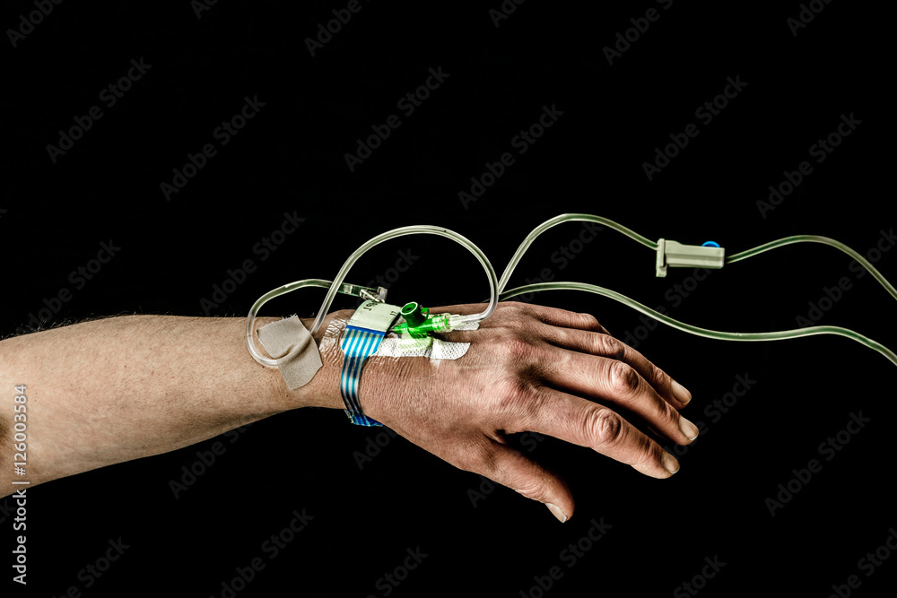 Hand and arm of patient with iv treatment on black background. Stock ...