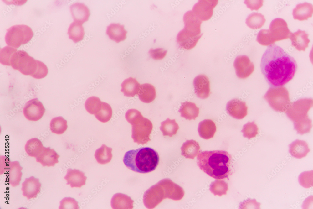 White Blood Cells Slide