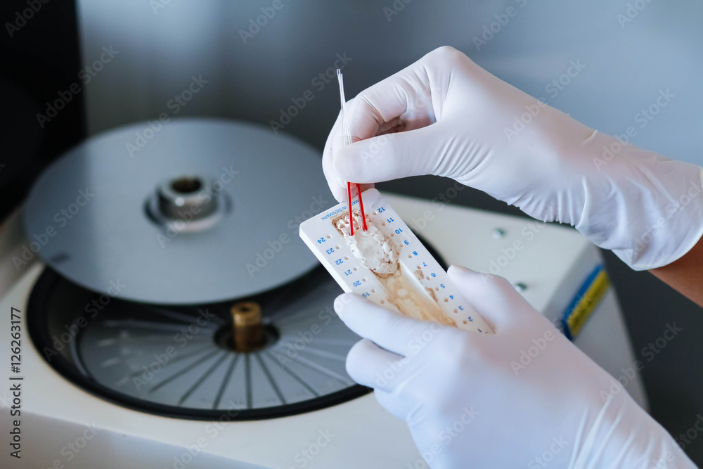 blood sample for hematocrit testing Stock Photo | Adobe Stock