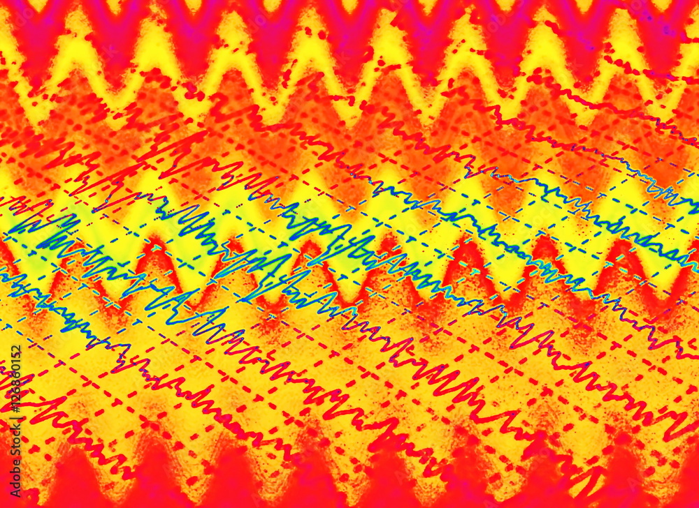 brain wave on electroencephalogram, EEG for epilepsy, illustration ...