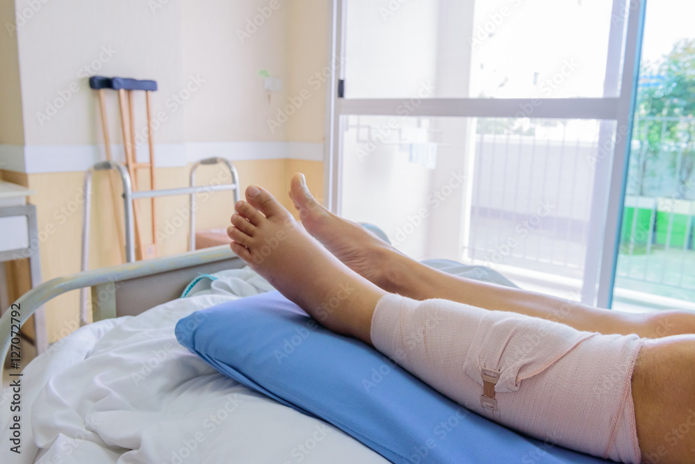 Patient laying in a hospital bed her a broken leg Stock Photo | Adobe Stock