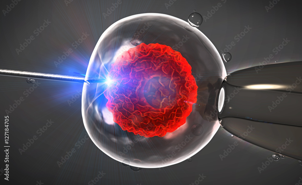 Illustration of an artificial insemination or in-vitro fertilization of ...