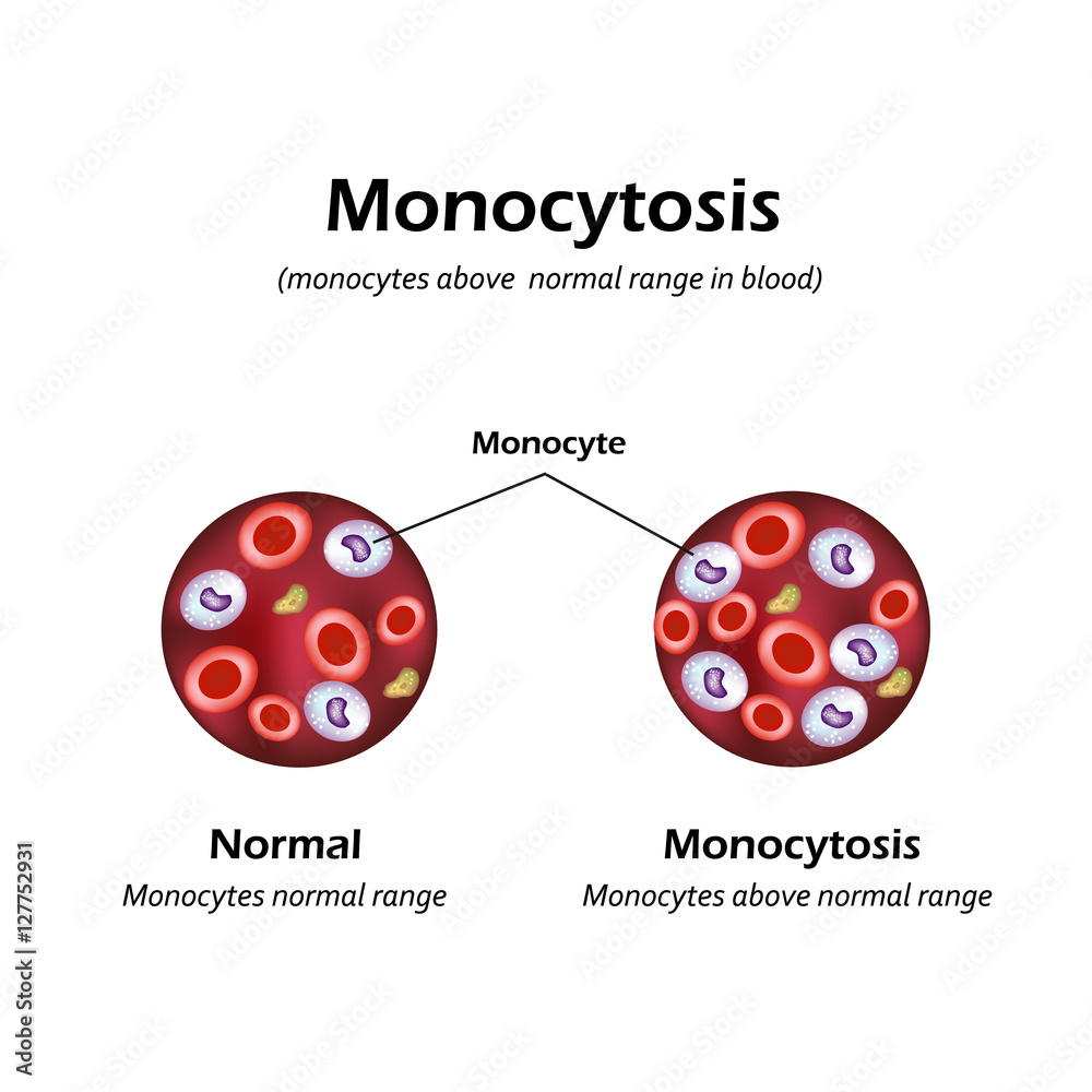 Normal Monocytes