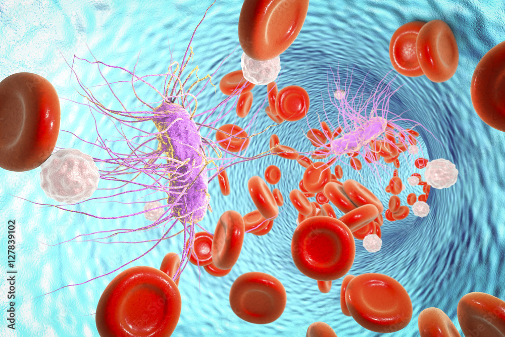Escherichia coli bacterium in blood, 3D illustration. Sepsis ...