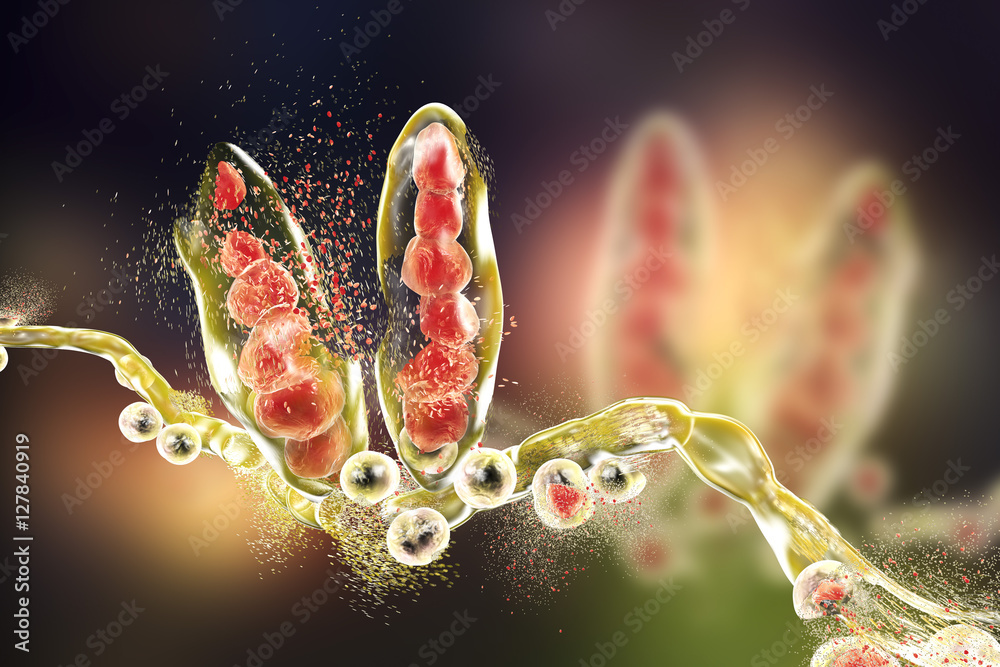Destruction of fungus Trichophyton mentagrophytes which causes athlete ...