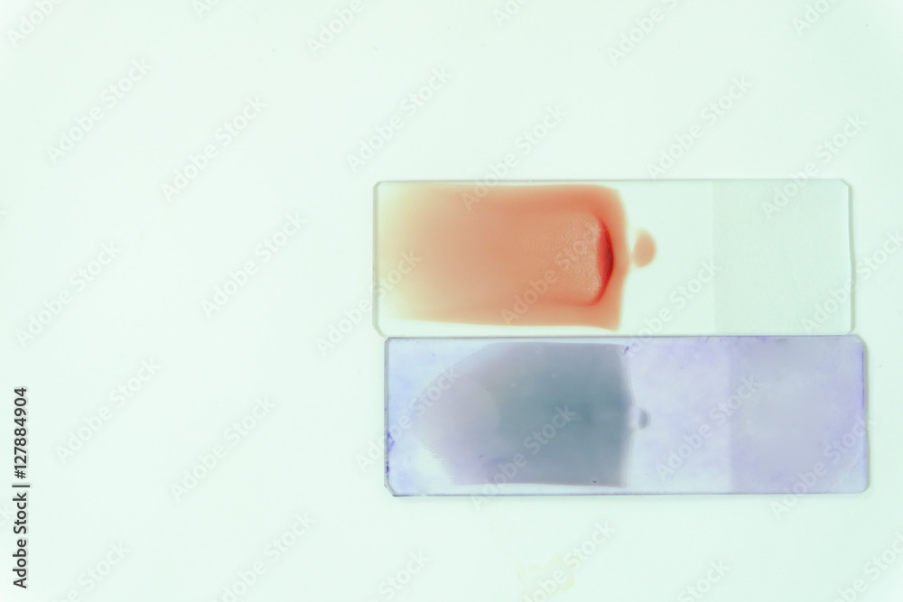 Blood smear for hematology microscopic examination Stock Photo | Adobe ...