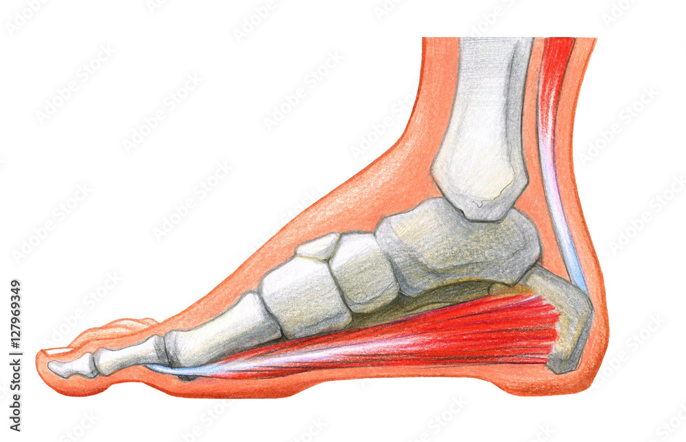 Foot, Scheme of foot with the corn and plantar callosityon a white ...