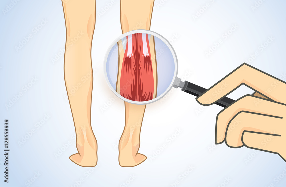 Zoom in Calf Muscle of human with magnifier for check Muscular System ...