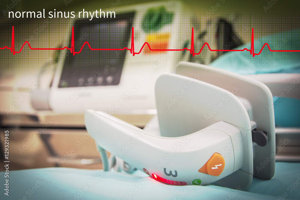 EKG or ECG monitor in emergency room and normal sinus rhythm wav Stock ...