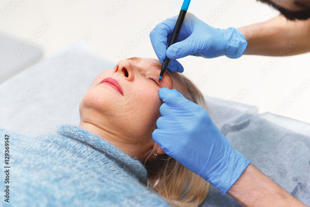 marking the face of an elderly woman old of plastic surgery at a ...