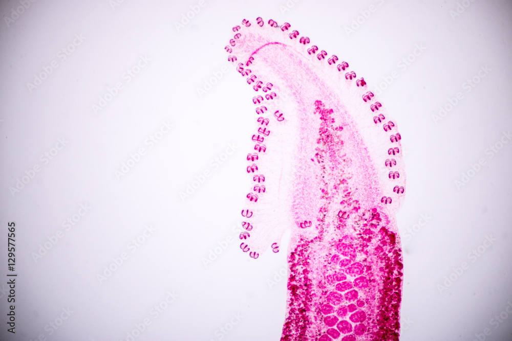 Foto de Flukes infestation (parasite) under microscope view. do Stock ...
