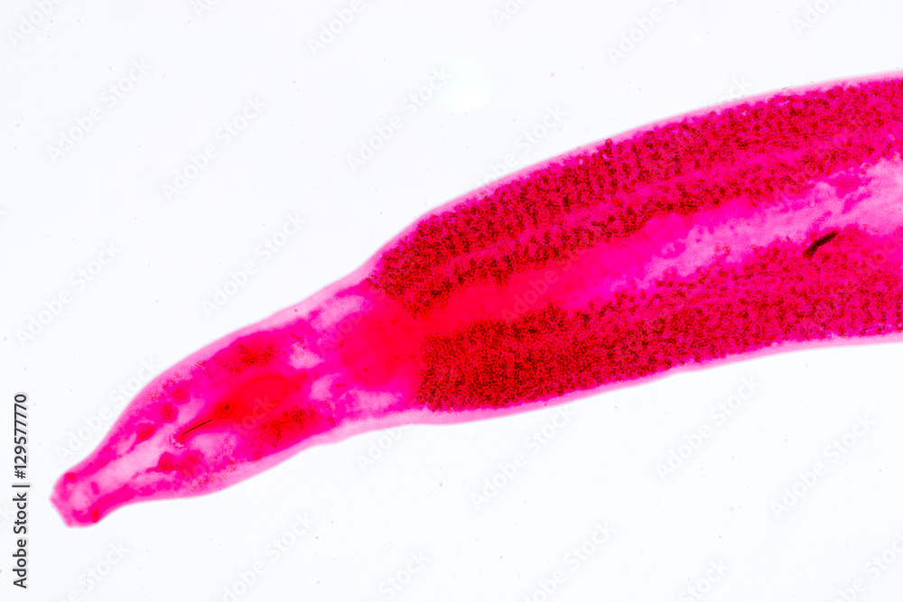 Fotka „Flukes infestation (parasite) under microscope view.“ ze služby ...