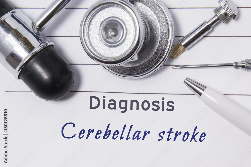 Diagnosis of Cerebellar Stroke. Medical doctor's statement with ...