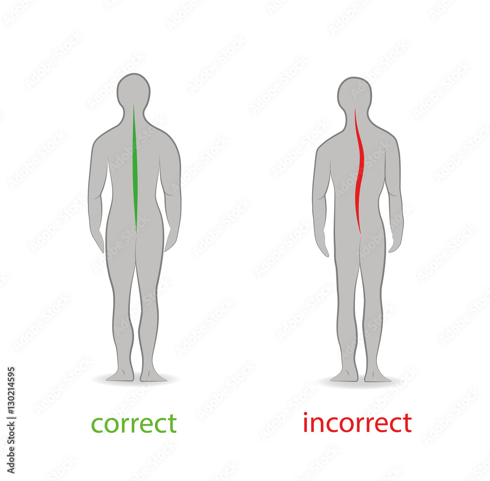 Correct alignment of human body in standing posture for good ...