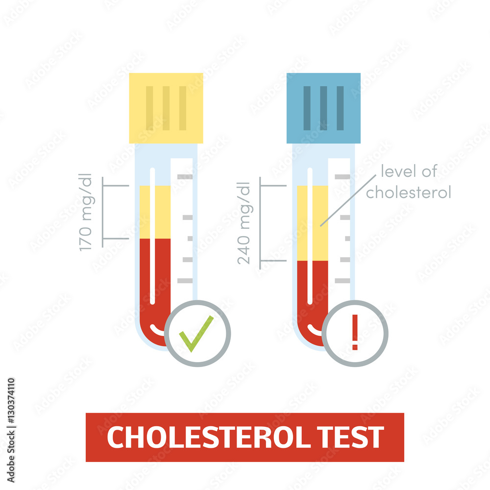 Cholesterol test concept Stock Illustration | Adobe Stock