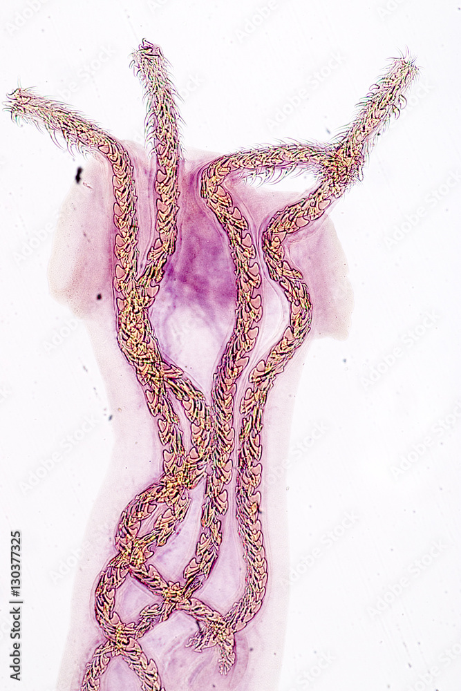 Shirleyrhynchus sp. (parasite) on slide under the microscope. under ...