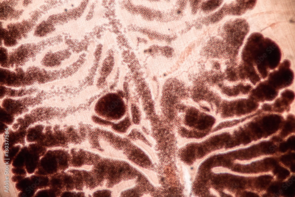 Mature proglottid (parasite) on slide under the microscope. under ...