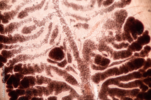 Mature proglottid (parasite) on slide under the microscope. under ...