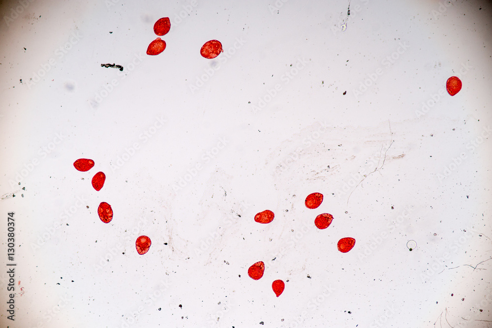 Cycts parasite on slide under the microscope. under microscope view ...