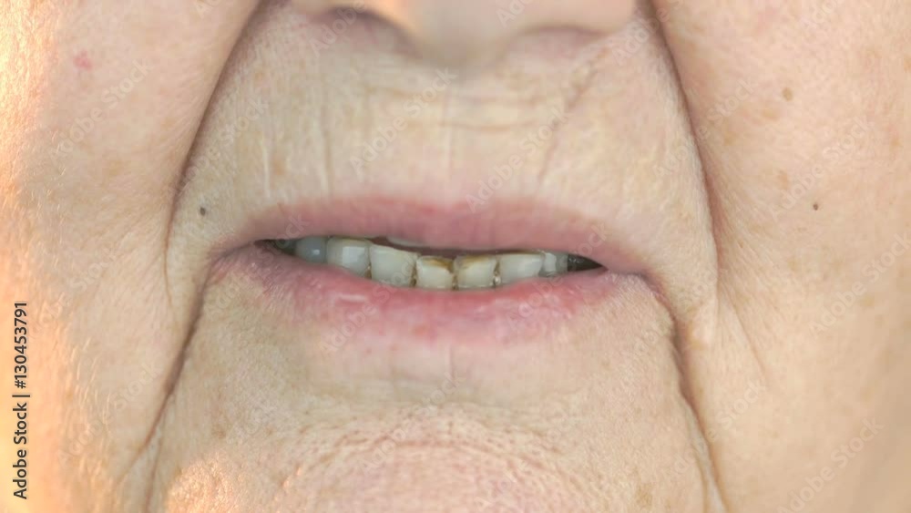 The elderly woman smiling with false teeth. Close up Stock Video ...